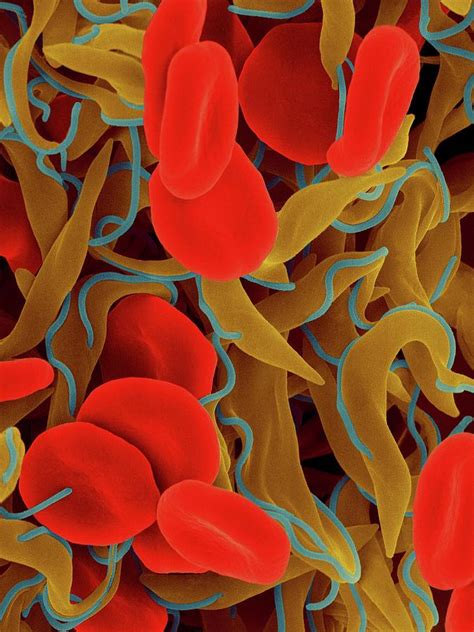 Trypanosome Trypomastigote And Red Blood Cells Photograph By Dennis