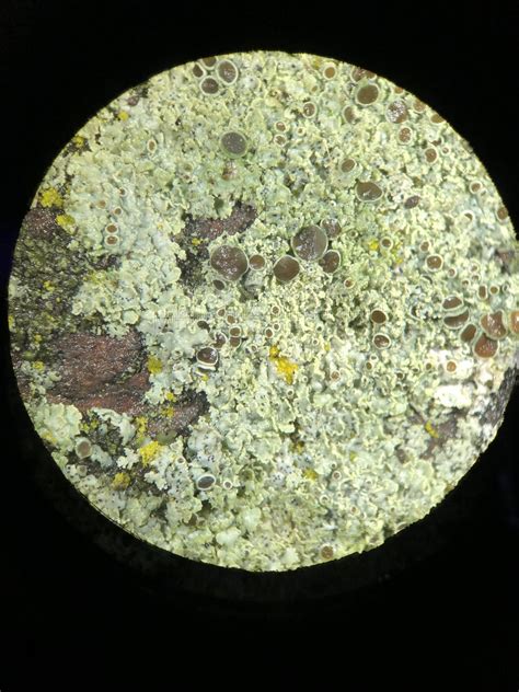 Some Lichen Under The Scope R Lichen