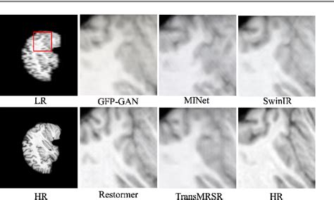 Transmrsr Transformer Based Self Distilled Generative Prior For Brain