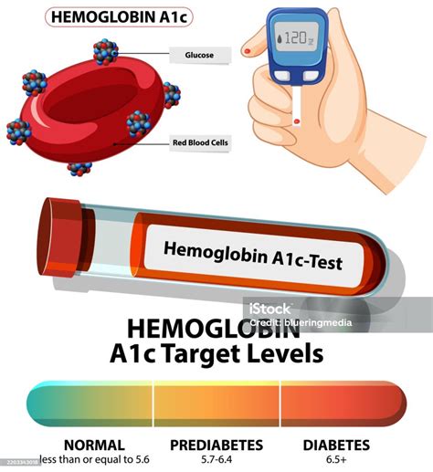 Illustration Of Hemoglobin A1c Test And Glucose Levels Stock