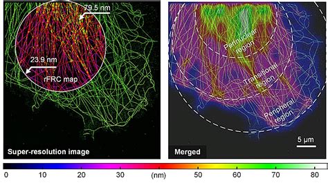 Rolling Fourier Ring Correlation Method Maps Local Quality At Super
