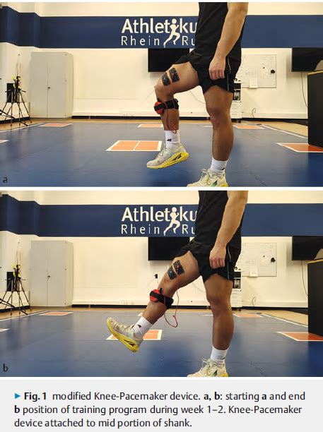 Knee Pacemaker And Ami Shoulder Pacemaker