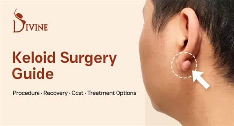 Adult Stapler Circumcision Benefits Procedure And Recovery