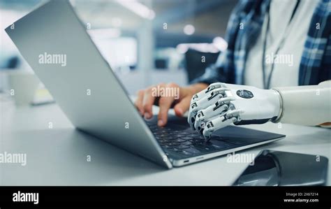 Close Up On Hands Programmer With Disability Using Prosthetic Arm To