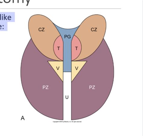 Block 6 Path Benign Prostatic Hyperplasia Flashcards Quizlet