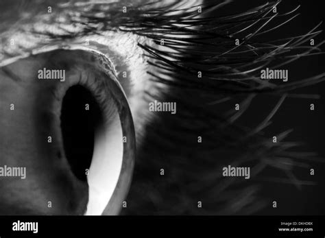Genetic Mutation In Human Eyes