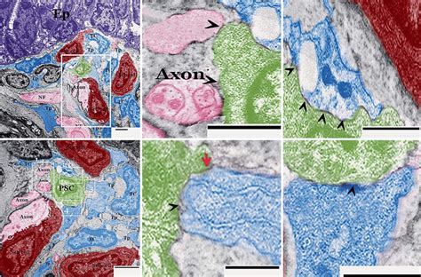 Digitally Colored Tem Images Illustrating The Relationships Of Tcs With