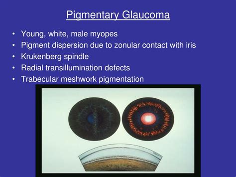 Ppt Drksudhamathi Consultant Eyeq Superspeciality Hospitals