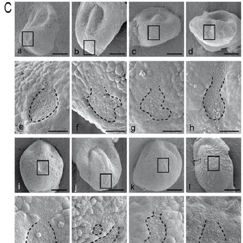Laterality And Nodal Flow Defects And Abnormal Node Pnc Structure In Download Scientific