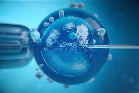 Assisted Reproductive Technologies In Vitro Fertilization The