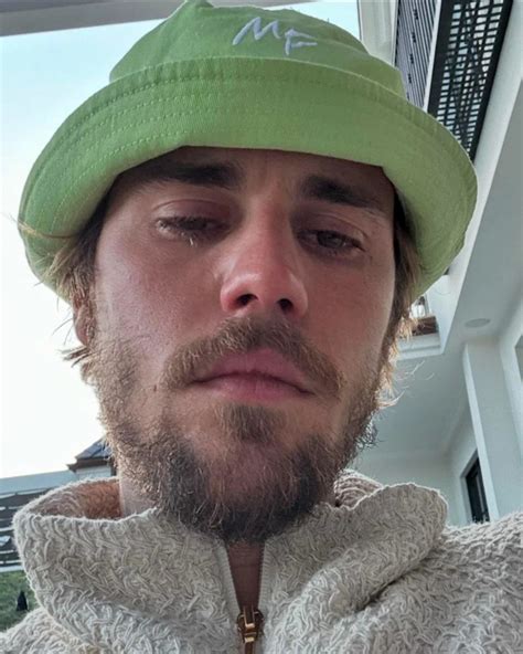 Justin Bieber Finally Addresses His Disheveled Look Amid Claims He Is