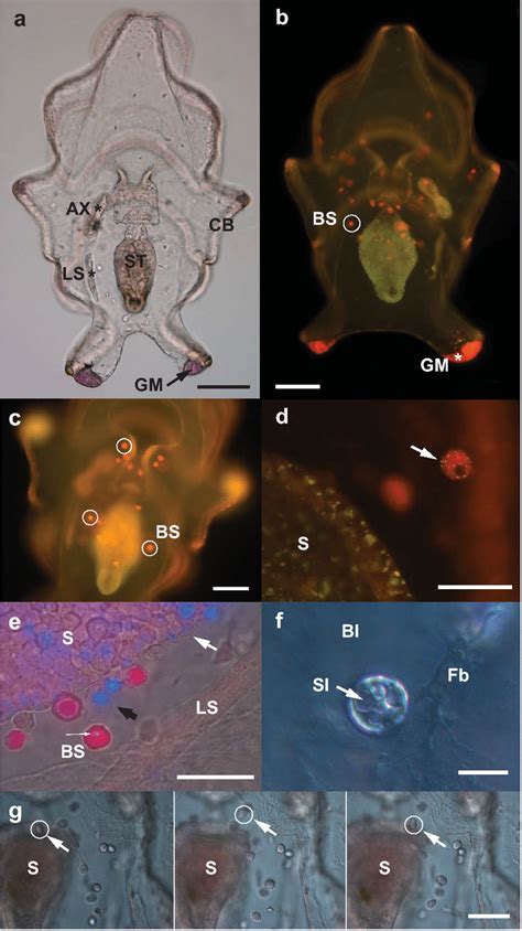 Late Auricularia Of A Mollis A Light Microscope View Of General