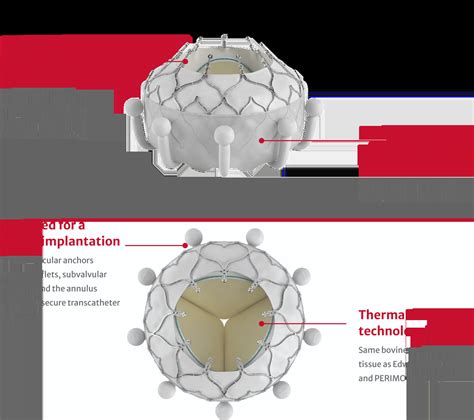 Evoque Tricuspid Valve Replacement Edwards Lifesciences