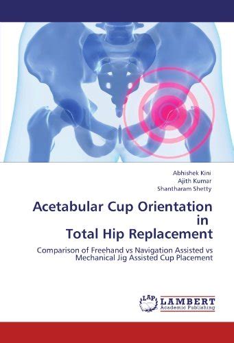 Buy Acetabular Cup Orientation In Total Hip Replacement Comparison Of
