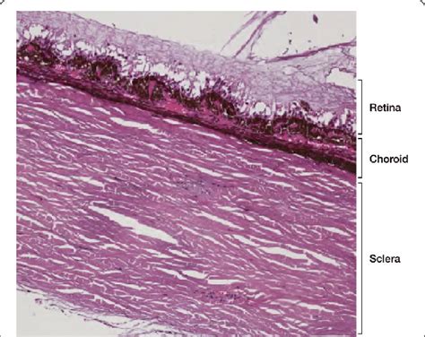 Histology Of Choroid Of Eye