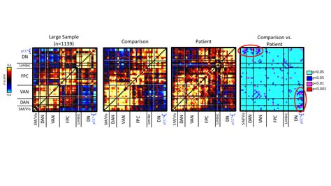 Reconfiguration Of Intrinsic Functional Coupling Patterns Following