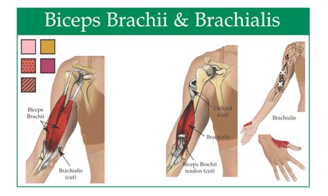 Physio Health Climbers Elbow Brachialis Tendonitis