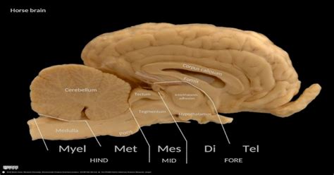 Ppt Teldimesmetmyel Corpus Callosum Fornix Interthalamic Adhesion Tectum Tegmentum Cerebellum