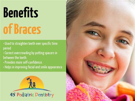 17 Best Images About Next Step Braces On Pinterest Smile Brushing