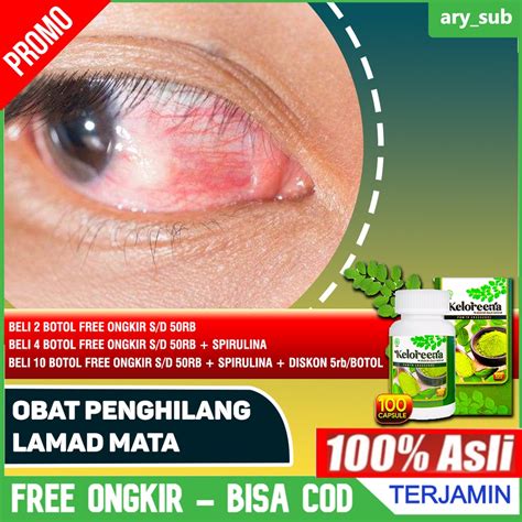 Mata Medication To Remove Old Eyes Fatty Eyes Pterygium Eyes