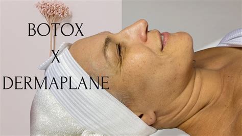 Can You Use A Face Mask After Dermaplaning At Keith Maxey Blog