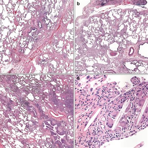 Variation In Overall Diagnosis Of Cases In Initial Round Including Download Scientific Diagram