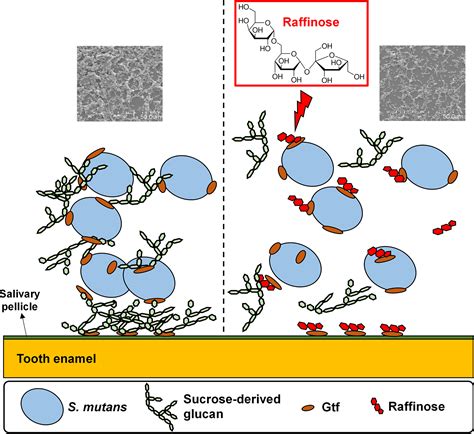 Streptococcus Mutans