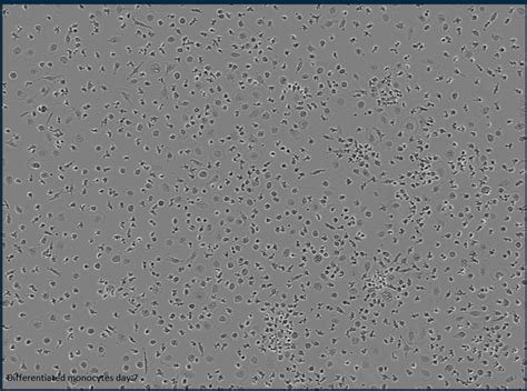 What Are Key Morphological Differences In Phase Images Between