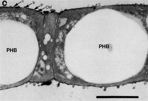 Transmission Electron Micrographs Of Thin Section Of Ruthenium