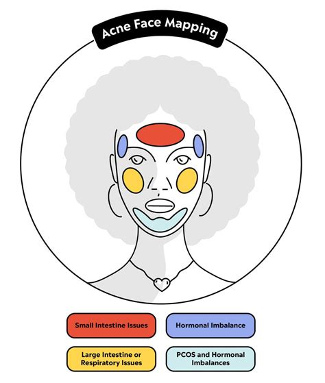 Pimples On Face Diagram Ayurvedic Face Mapping Face Mapping Ayurveda