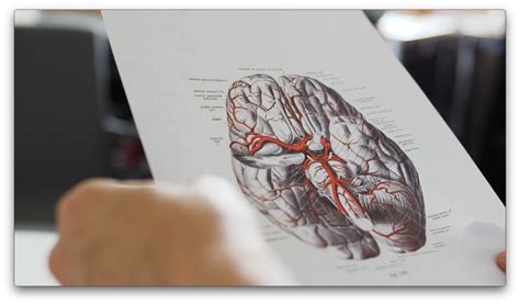 Deep Brain Vessel Profiler Treating Strokes Individually With Deep