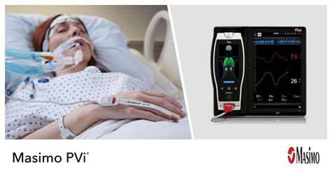 Masimo On Linkedin News And Media