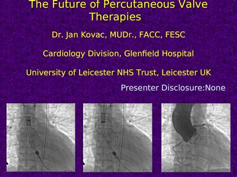 Ppt Interventional Techniques Dokumen Tips