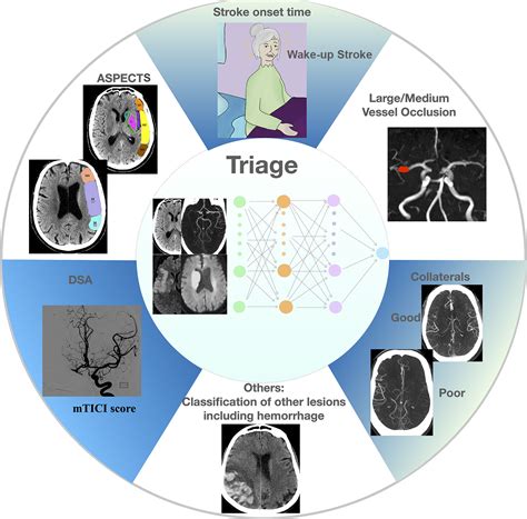 Deep Learning Applications In Imaging Of Acute Ischemic Stroke A