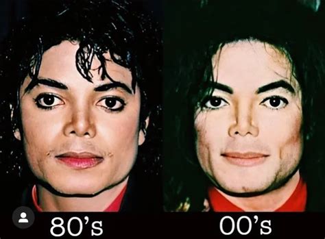 Michael Jackson Plastic Surgery Exploring The Transformations