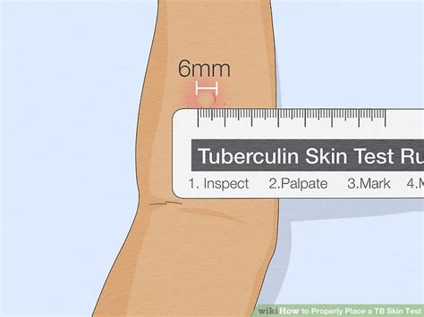 How To Properly Place A Tb Skin Test With Pictures Wikihow
