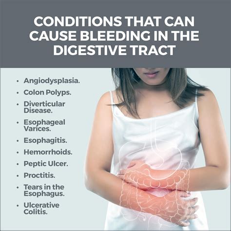 Bleeding In The Digestive Tract Gastro Md