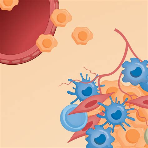 Nature Portfolio On Linkedin Drug Resistant Cell Lines In Cancer