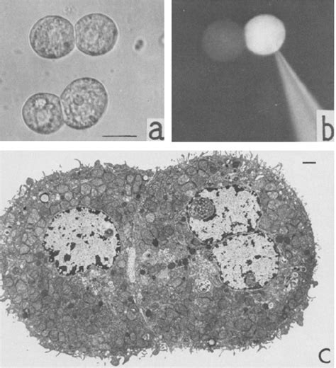Light Micrographs And Ultrastructure Of Freshly Dissociated Hepatocyte