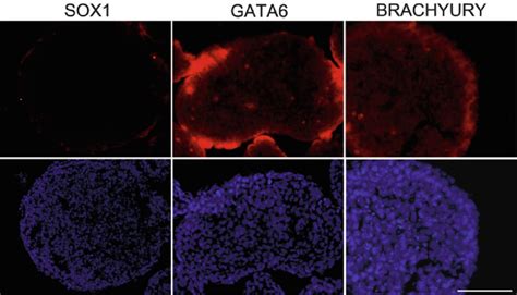 Immunocytochemical Staining Of Ectoderm Marker Sox1 Endoderm Marker