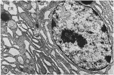 Nucleus Of Maximally Stimulated Epithelial Cell 12 Days Of Des Download Scientific Diagram