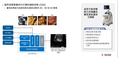 fpga在医疗的应用，以4k医疗内窥镜为例 内窥镜 fpga解决方案 csdn博客