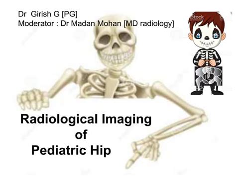 Pediatric Hip Radiology Pptx