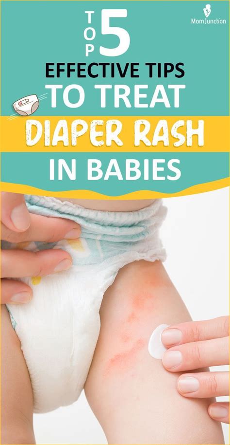Yeast Diaper Rash Artofit