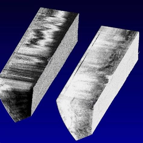 Media 1 Video Clip Of 3d Ps Oct Image Of Polyp Download Scientific