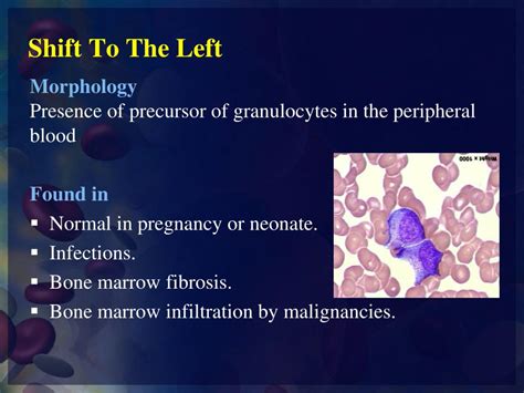What Does Left Shift Mean In Wbc At Harrison Fong Blog