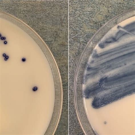 Detection Of Vre With Spectra ™ Vre Agar In Rectal Swabs Growth