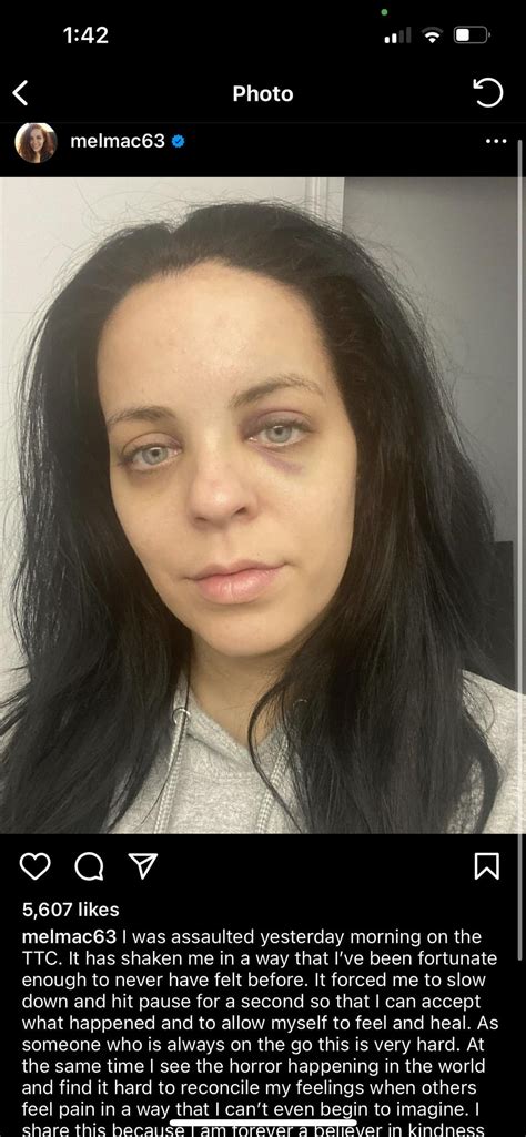 Ashley From Degrassi This Is So Sad Rdegrassi