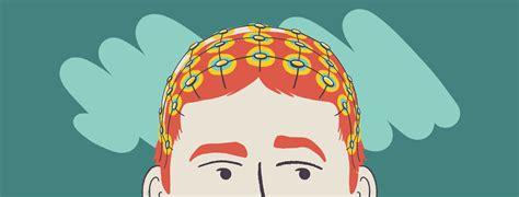 A New Specialist And An Electroencephalogram Eeg What I Learned