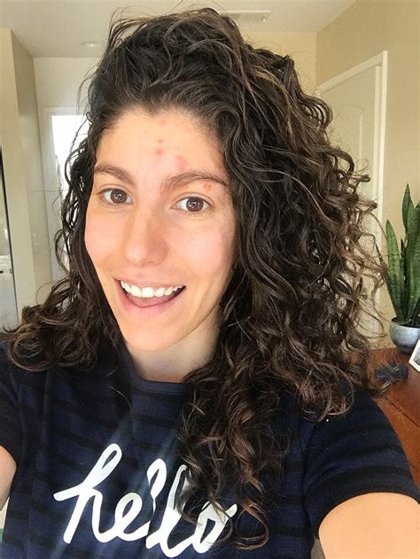 How To Recover From Shingles Quickly The Healthy Maven